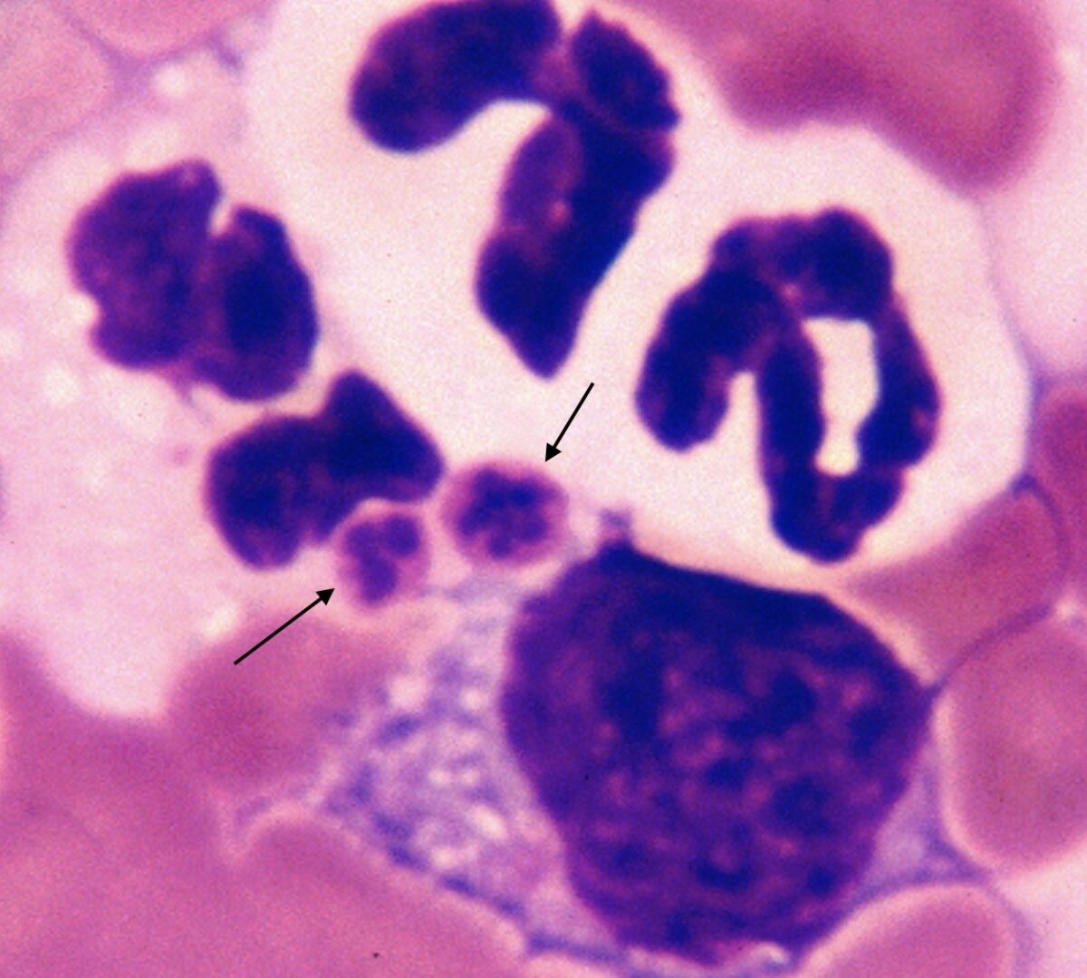 Ehrlichiose du chien à Ehrlichia canis… et quelques autres - Clinique ...